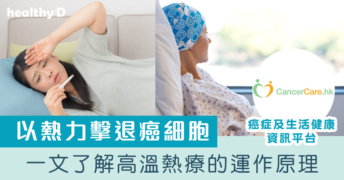 癌症治療 | 以熱力擊退癌細胞 一文了解高溫熱療的運作原理 - 癌症及生活健康資訊平台CancerCare.hk | healthyD.com