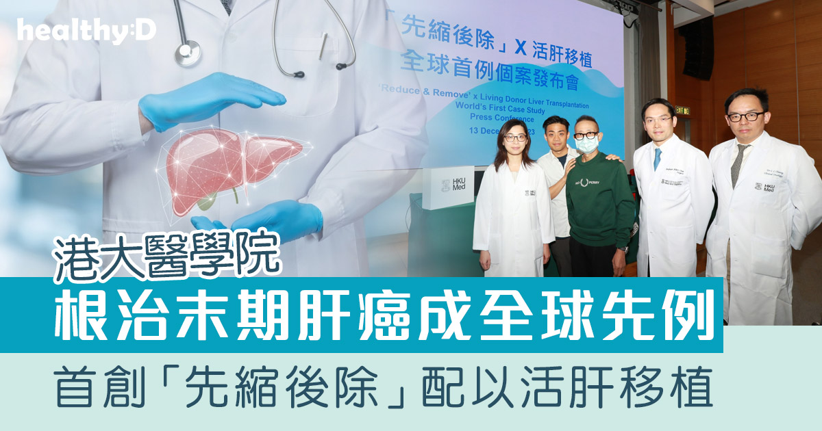 肝癌治療｜全球首例！港大醫學院創「先縮後除」配以活肝移植根治末期肝癌 | healthyD.com
